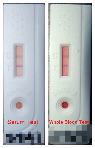 One-Step Foot and Mouth Disease (FMD)NSP Ab Rapid Test